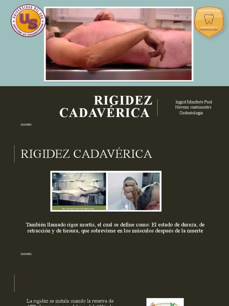Rígidez Cadavérica | PDF | Músculo | Anatomía
