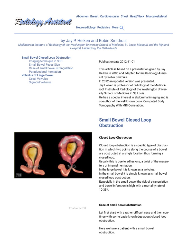 Small Bowel Closed Loop Obstruction | PDF | Large Intestine | Clinical ...