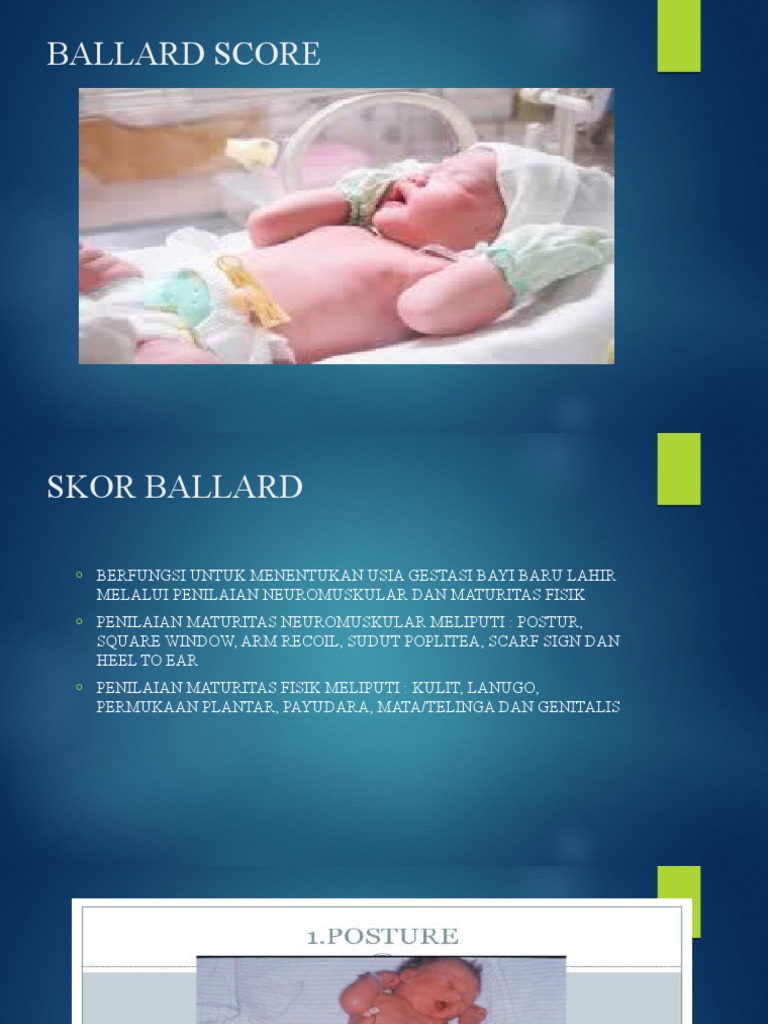 New Ballard Score | PDF