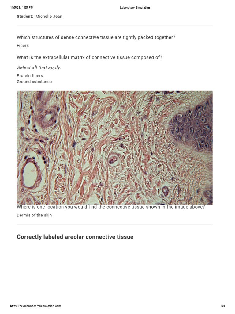 Dense Connective Tissue Overview | PDF | Science & Mathematics