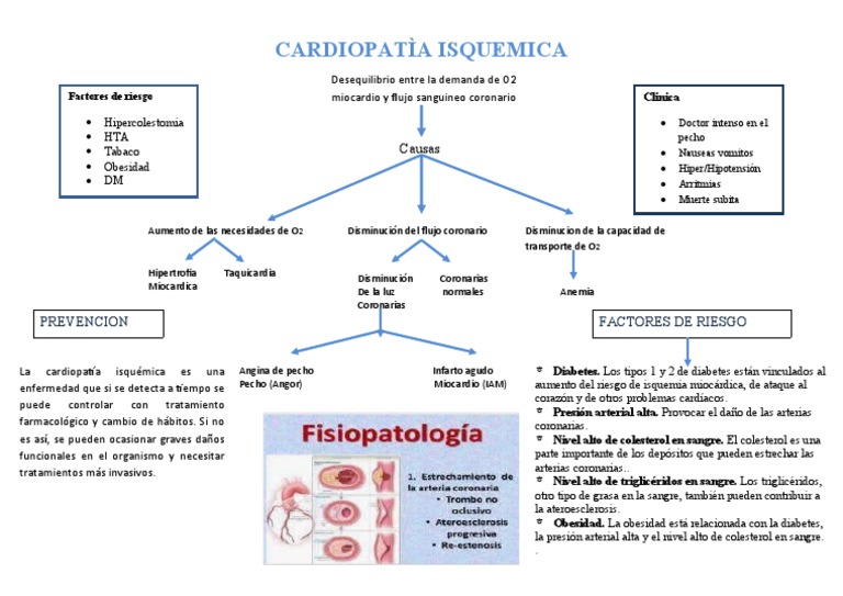 Mapa Cardiopatia Isquemica | PDF | Isquemia | Músculo cardíaco