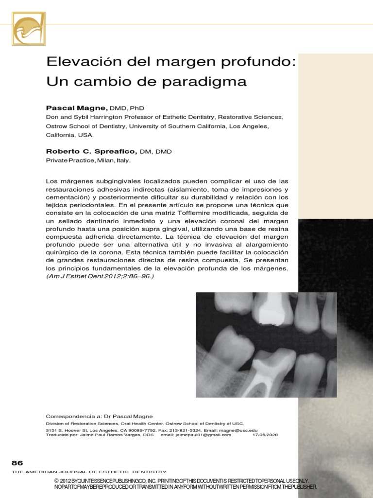 Magne Spreafico 2012 Deep Margin Elevation A Paradigm Shift Desbloqueado | PDF | Compuesto ...