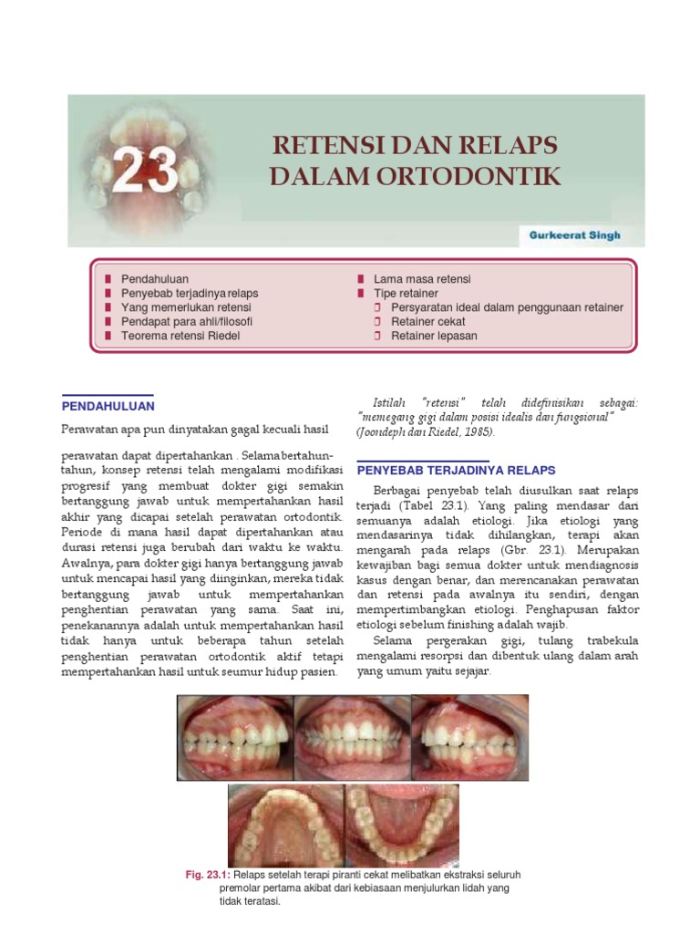 Retensi dan Relaps dalam Ortodontik | PDF | Kajian Bahasa Asing ...