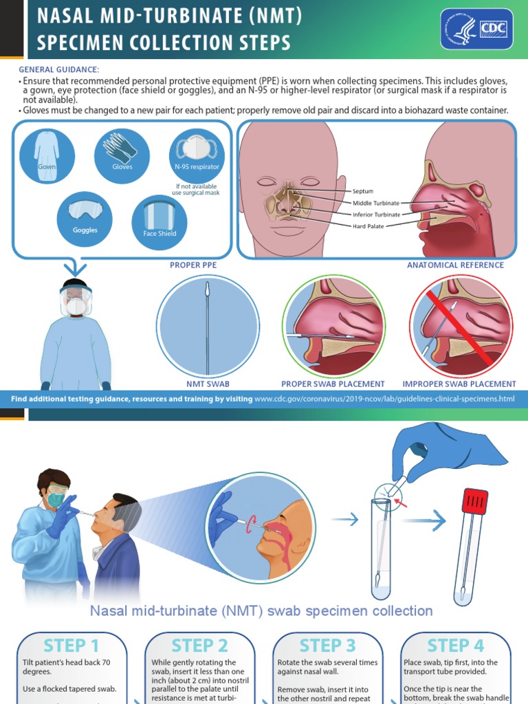 Proper Nasal Mid-Turbinate Swab Specimen Collection: A Step-by-Step ...