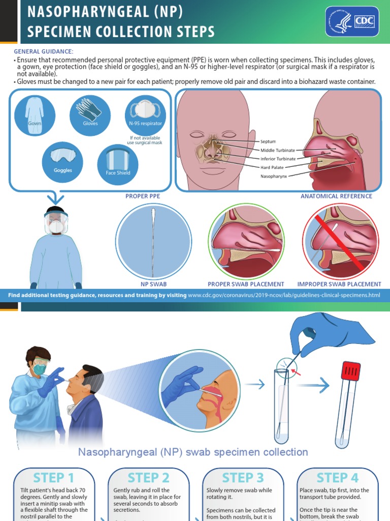 Nasopharyngeal Swab Collection Guide | PDF | Workplace | Personal ...