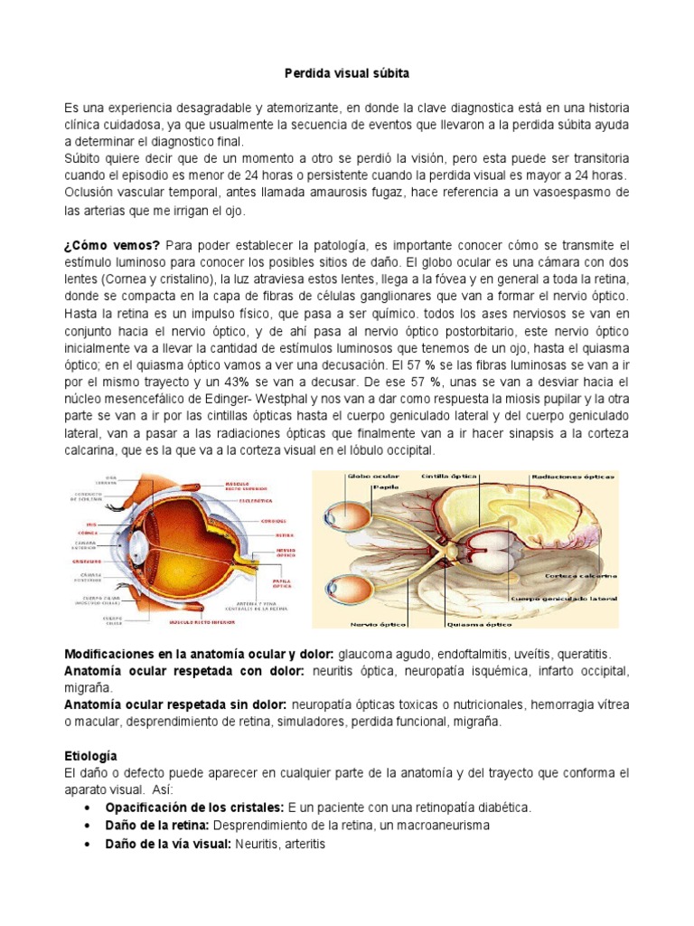 Perdida Visual Súbita | PDF | Percepción visual | Ojo humano