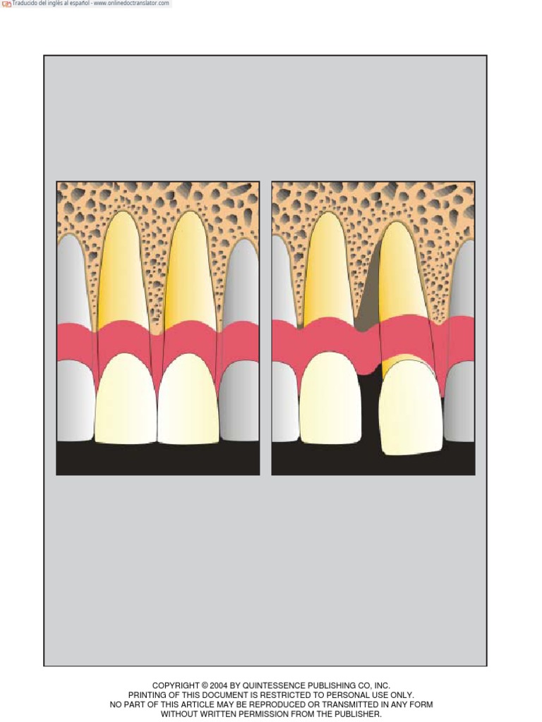 Cardaropoli 04. Indice Papilar 11111111111111.en - Es | PDF | Cara ...