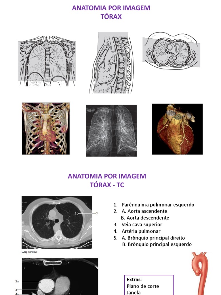 Estruturas anatômicas do tórax identificadas em imagens de tomografia ...