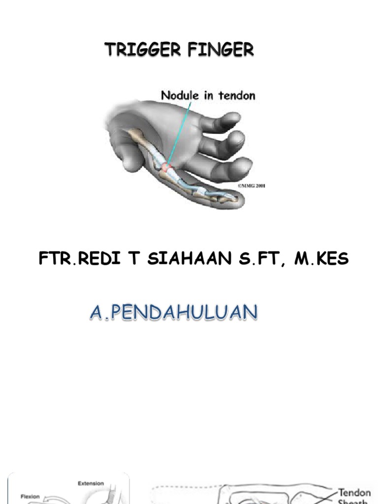 Panduan Trigger Finger dan Penanganannya | PDF