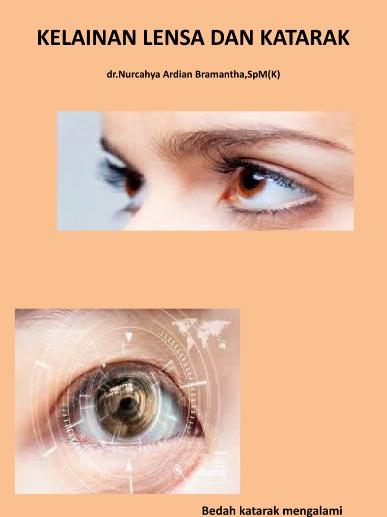 2019 Dr. Bram Kelainan Lensa Dan Katarak | PDF
