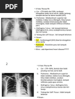 Analisis Foto Rontgen Thorax dan Abdomen | PDF