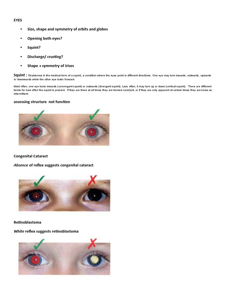 Eyes - Size, Shape and Symmetry of Orbits and Globes - Opening Both ...