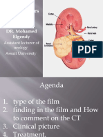 Types and Structure of Dialyzers | PDF | Hemodialysis | Dialysis