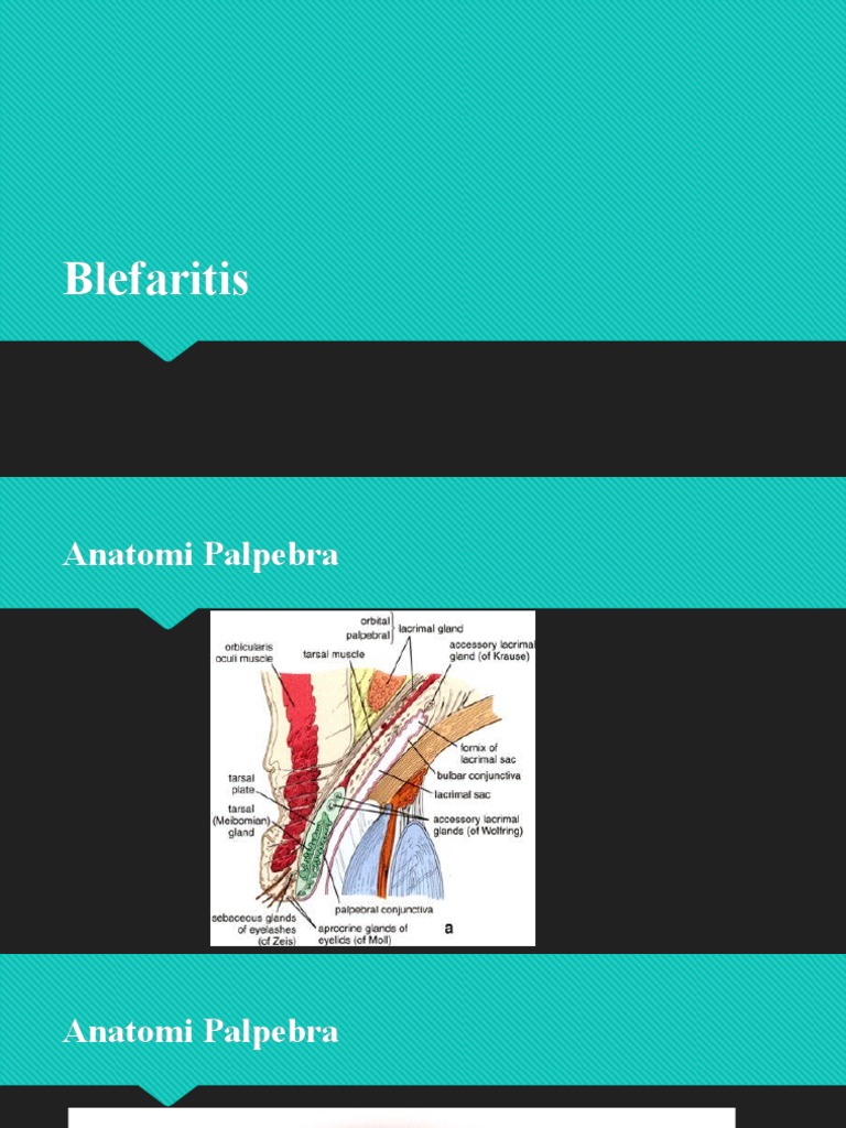 Panduan Lengkap Blefaritis dan Penanganannya | PDF