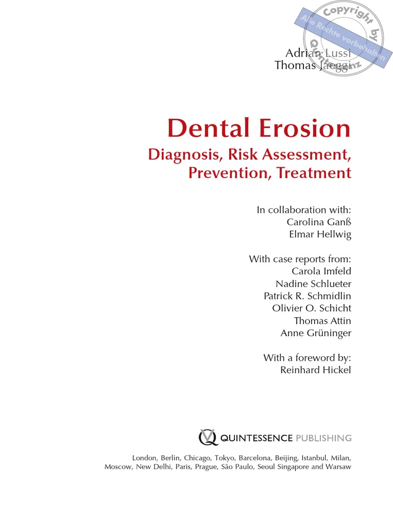 Dental Erosion: Diagnosis, Risk Assessment, Prevention, Treatment ...