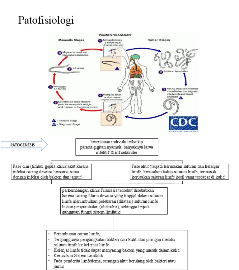 Patofisiologi & Patogenesis Filariasis | PDF