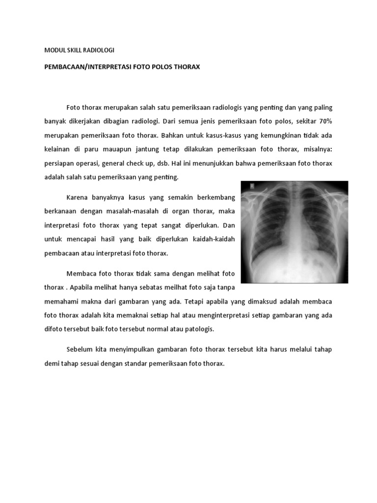 Interpretasi Foto Thorax Radiologi | PDF