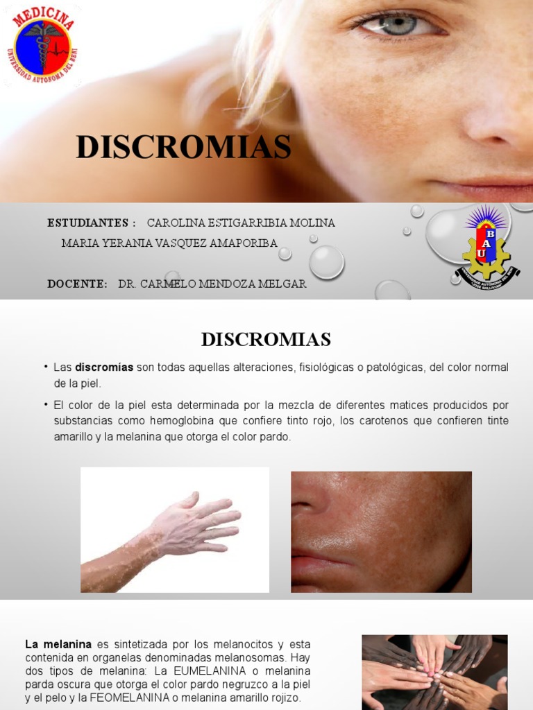 DISCROMIAS | PDF | Piel | Órganos sensoriales