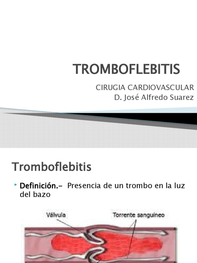 TROMBOFLEBITIS | PDF | Ciencia y matemáticas