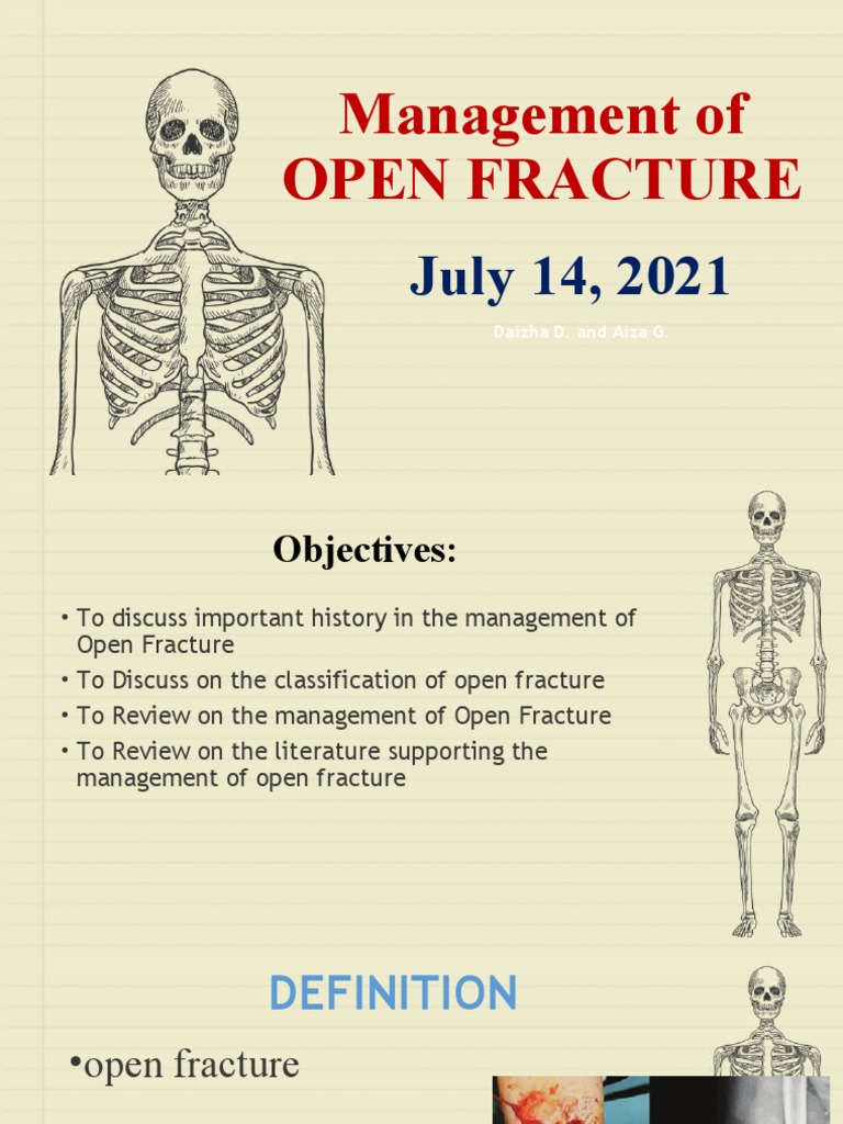 Open Fracture MAnagement | PDF | Wound | Clinical Medicine