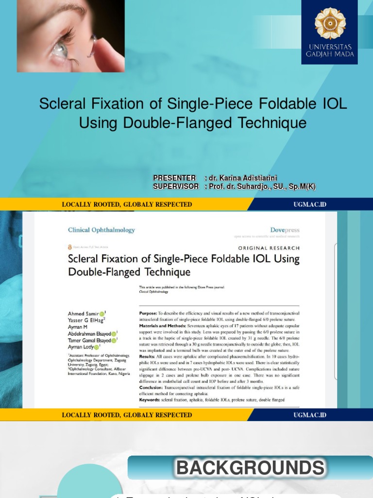 JR - KBR - Scleral Fixation of Single Pieces Foldable IOL Using Double ...