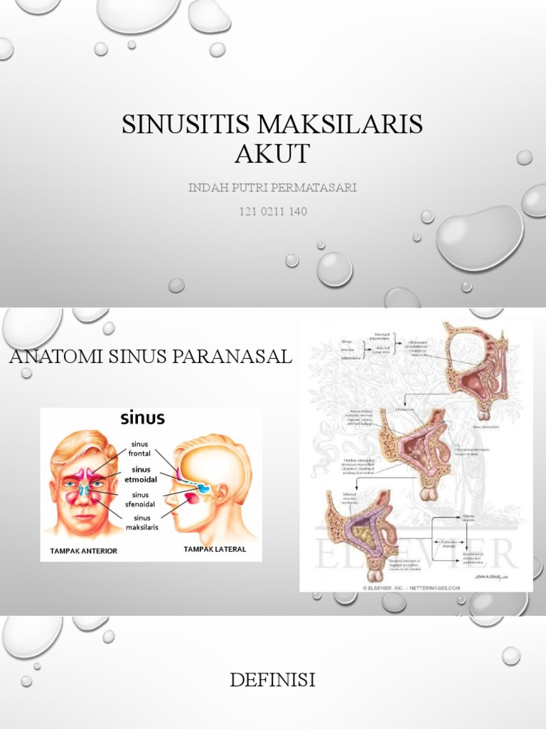 Sinusitis Maksilaris Akut | PDF