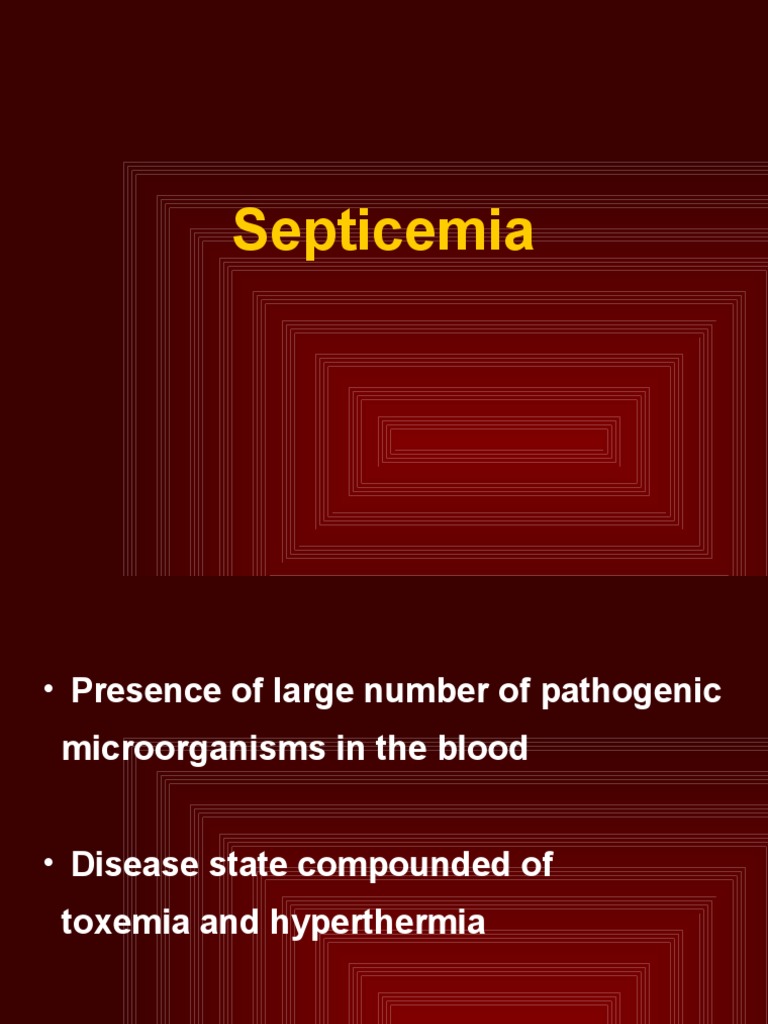 Septicemia | PDF