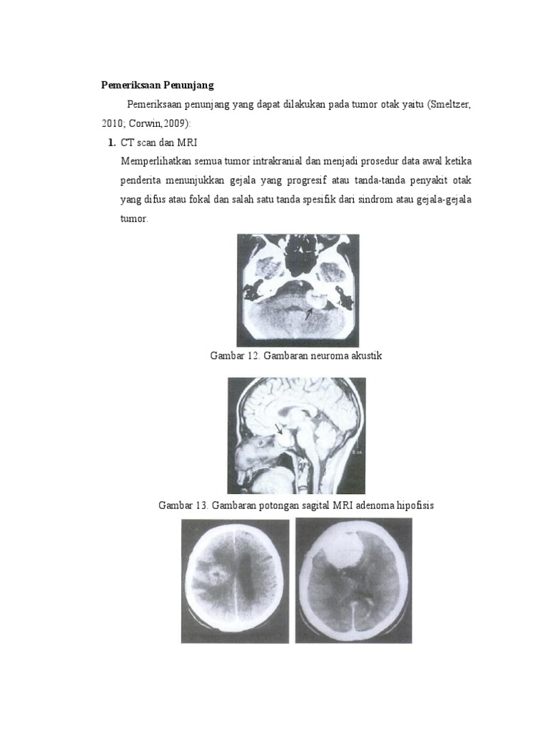 Pemeriksaan Penunjang Tumor Otak | PDF