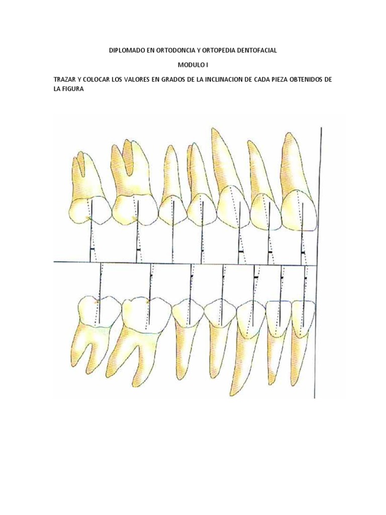 Trabajo de Torque y Tip de Andrews | PDF