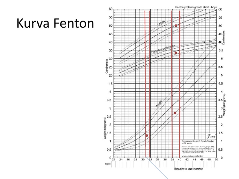 Kurva Fenton | PDF