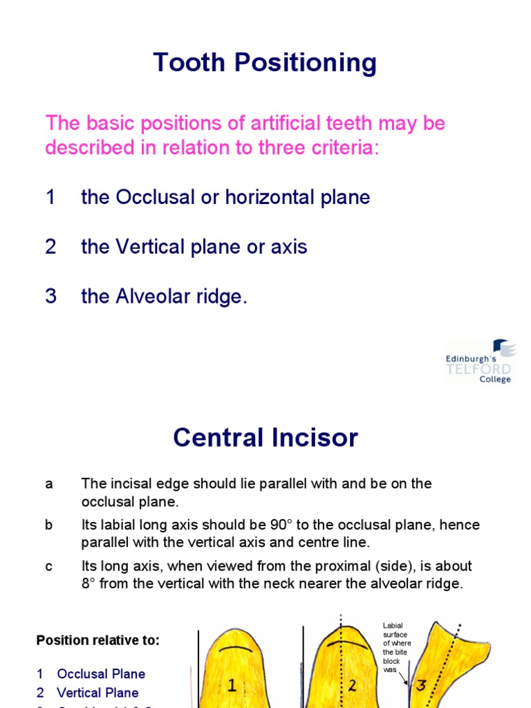 Tooth Positioning: The Basic Positions of Artificial Teeth May Be ...