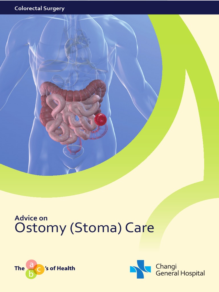Ostomy (Stoma) Care: Skin Complications: Signs of Food Blockage | PDF ...