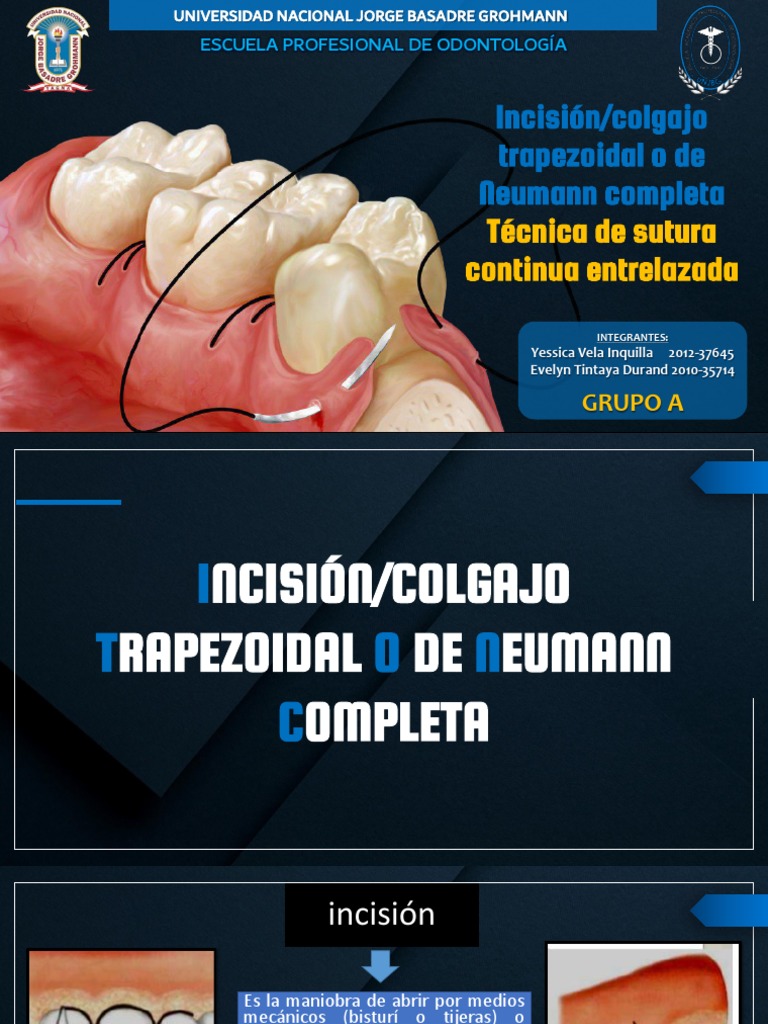Incisión Trapezoidal - Sutura Continua Entrelazada | PDF | Cirugía ...