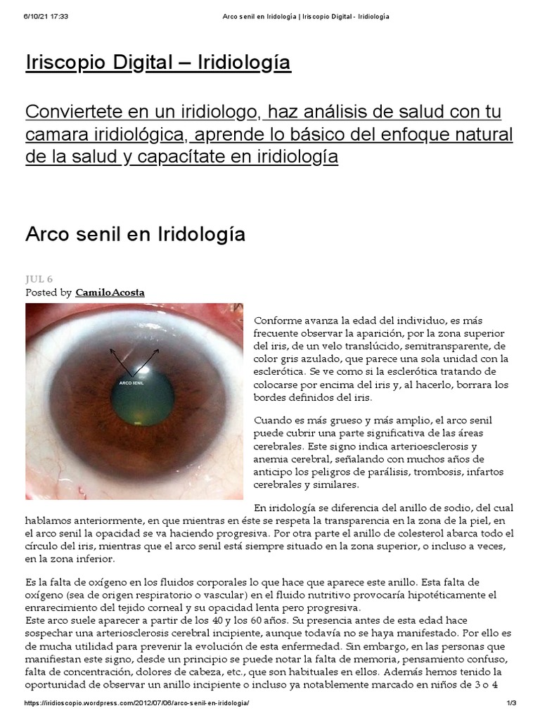 Arco Senil en Iridología - Iriscopio Digital - Iridiología | PDF ...
