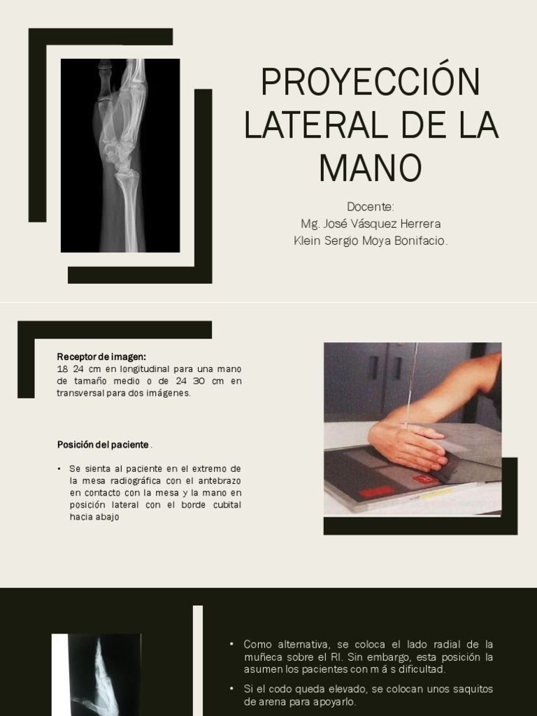 Proyeccion Lateral de La Mano | PDF