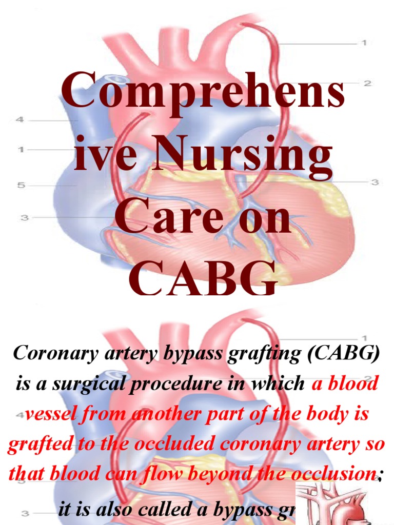 Comprehens Ive Nursing Care On Cabg | PDF | Coronary Artery Bypass ...