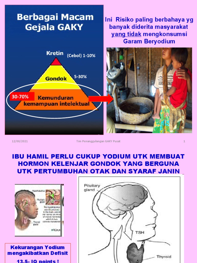 Bahaya Gangguan Akibat Kekurangan Yodium (GAKY) | PDF