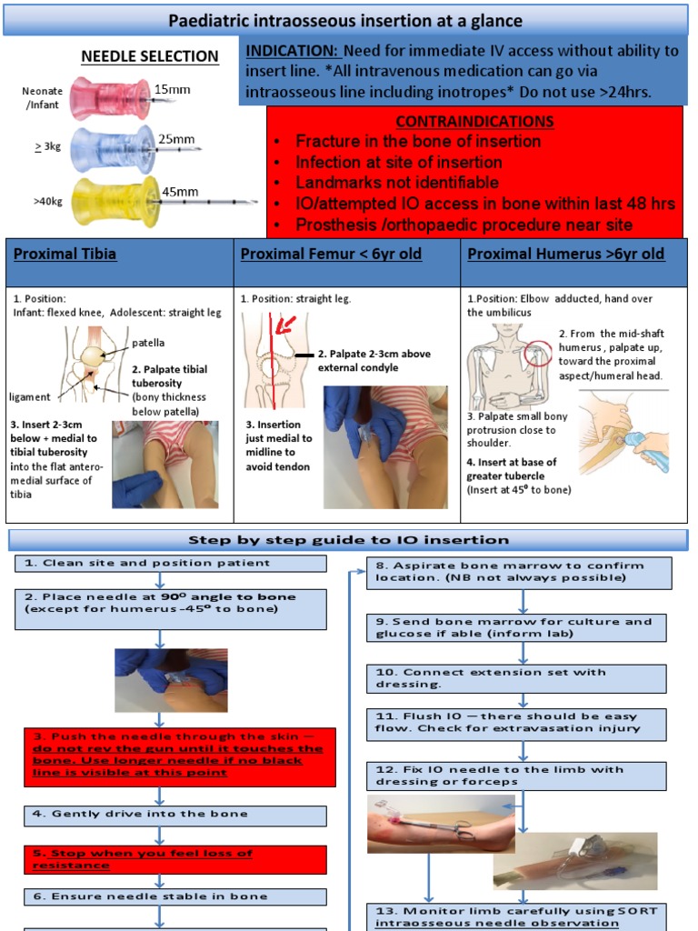 Intraosseous IO Insertion Guide | PDF | Medicine | Human Anatomy