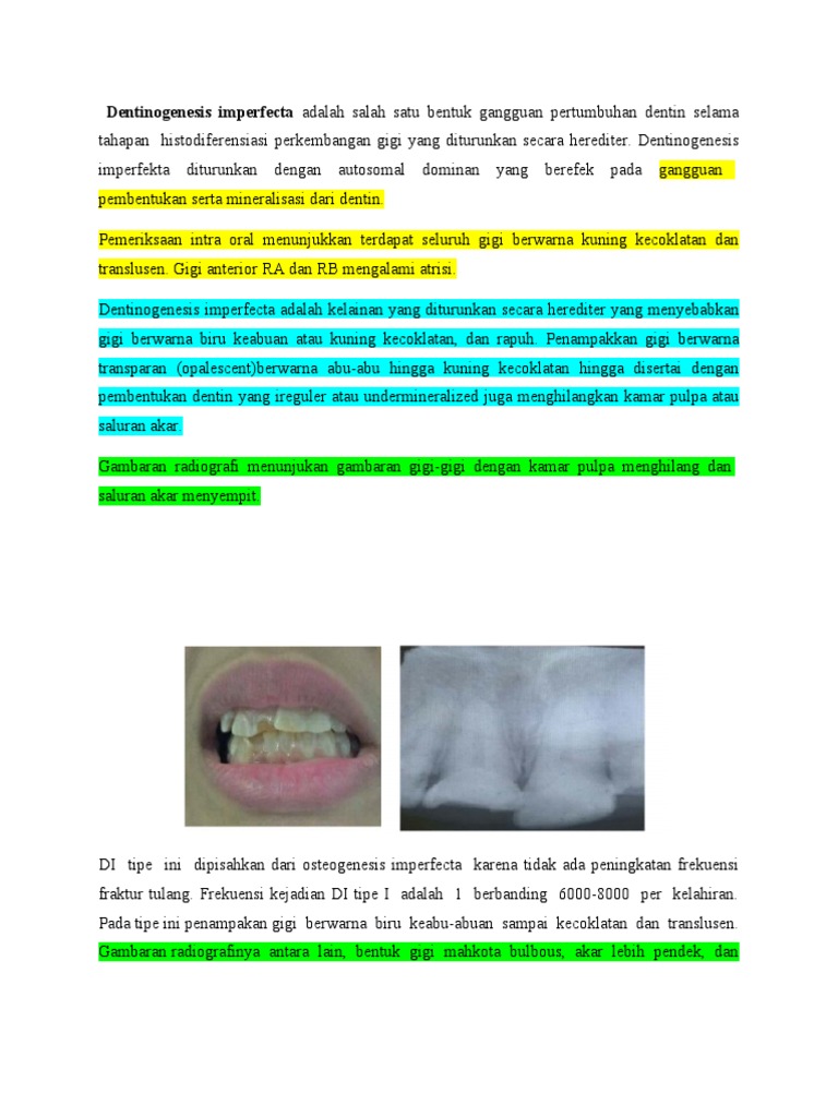 Dentinogenesis Imperfecta | PDF