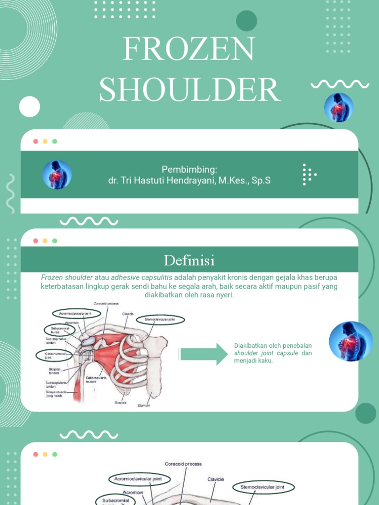 Frozen Shoulder | PDF