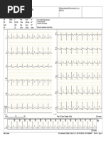 16-Handout - ECG Interpretation (Study This) | PDF ...