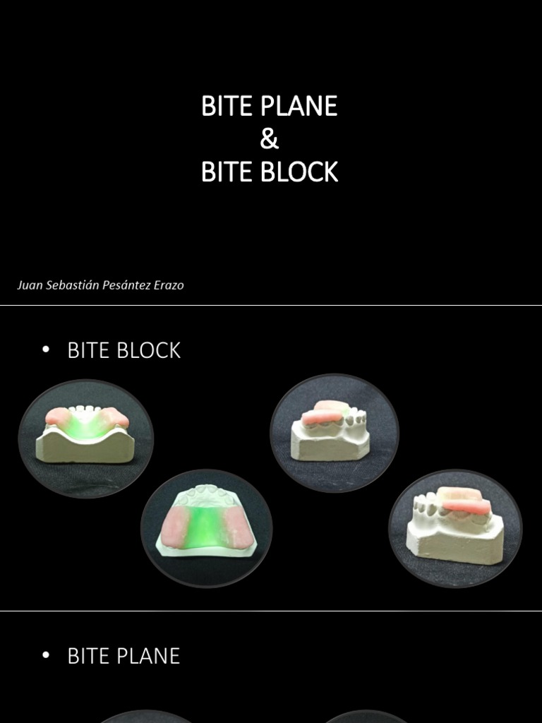 Bite Plane & Bite Block: Juan Sebastián Pesántez Erazo | PDF
