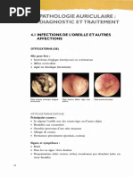 Anatomie du Labyrinthe Osseux de l'Oreille | PDF | Système vestibulaire ...