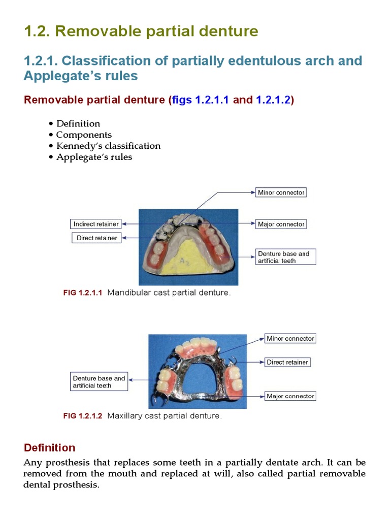 Removable Partial Denture | PDF | Dentures | Mouth