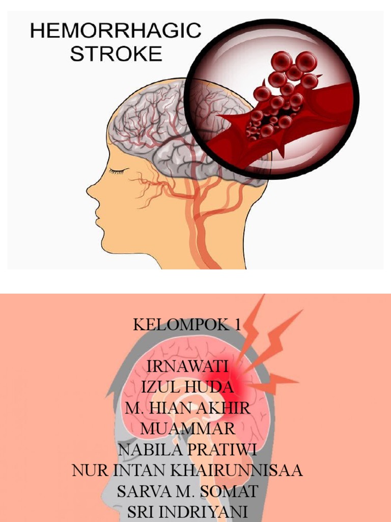 Kel. 1 (Stroke Hemoragic) | PDF
