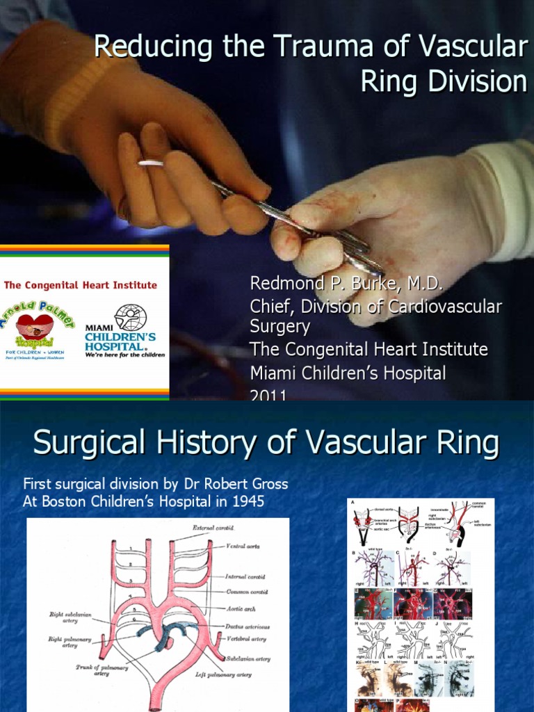 Vascular Ring Division: 2011 | PDF | Medicine | Health Care