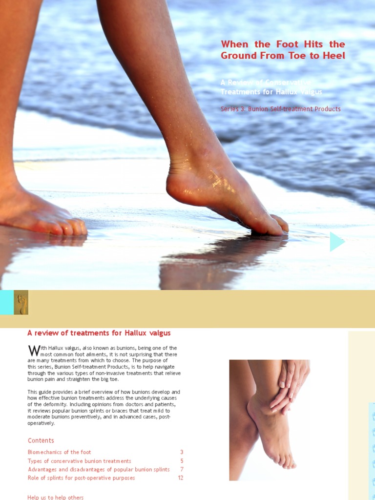 Ebook03 Splint Buyers Guide-04 | PDF | Foot | Lower Limb Anatomy