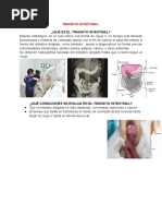 Sigmoidectomia Laparoscopica | PDF | Intestino grueso | Cirugía