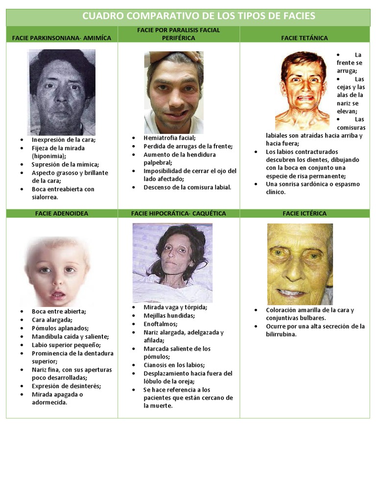 Tipos de Facies y sus Características | PDF | Cara | Especialidades Medicas