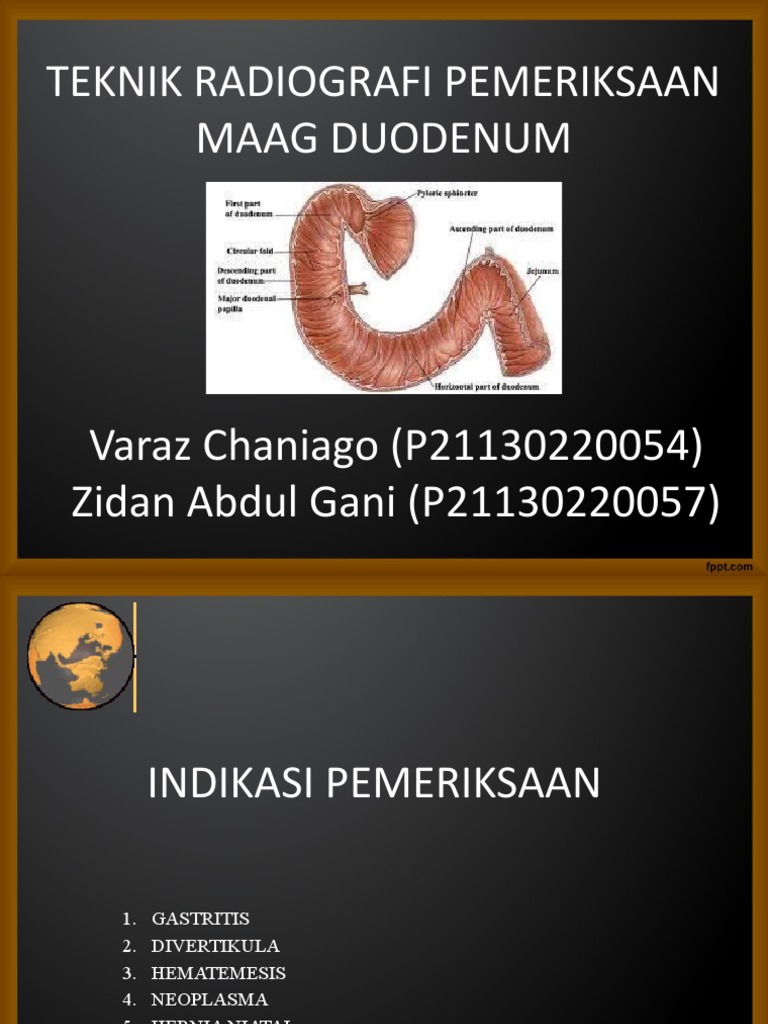 Maag Duodenum Varaz Chaniago | PDF